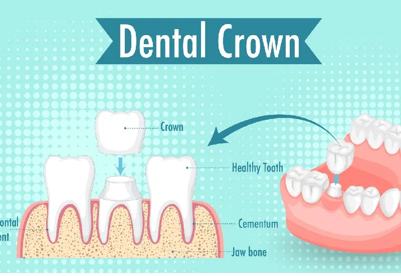 difference between crown and crowne